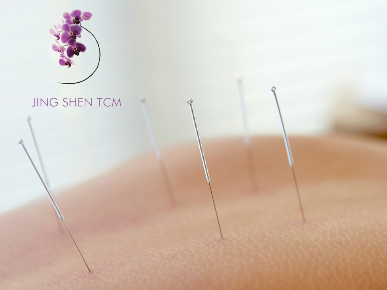 Jing Shen TCM - Traditional Chinese Medicine - Guernsey